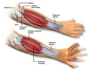 elbow-muscles – BEROVA KLİNİK - Ortopedi ve Travmatoloji - Orthopaedics ...